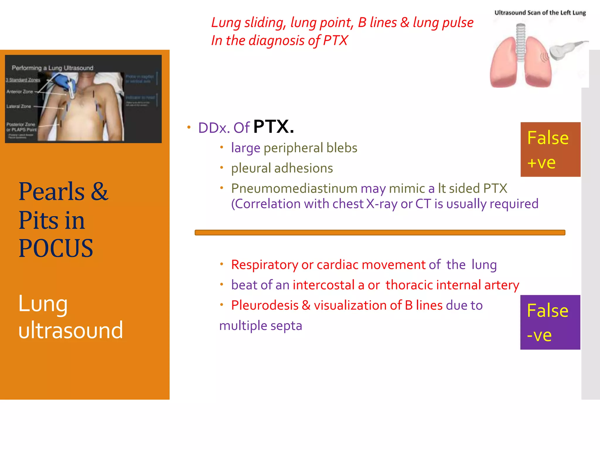 POCUS in critical care Jan 8th 2020 Teh Iran | PPTX