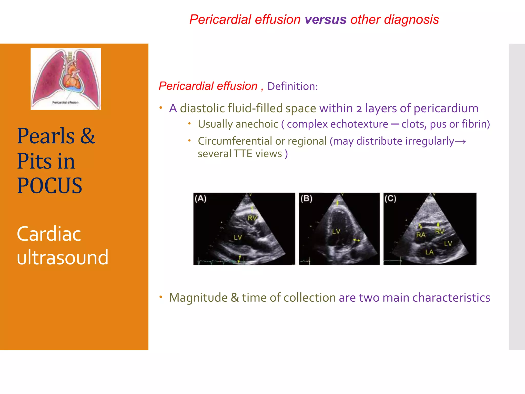 POCUS in critical care Jan 8th 2020 Teh Iran | PPTX