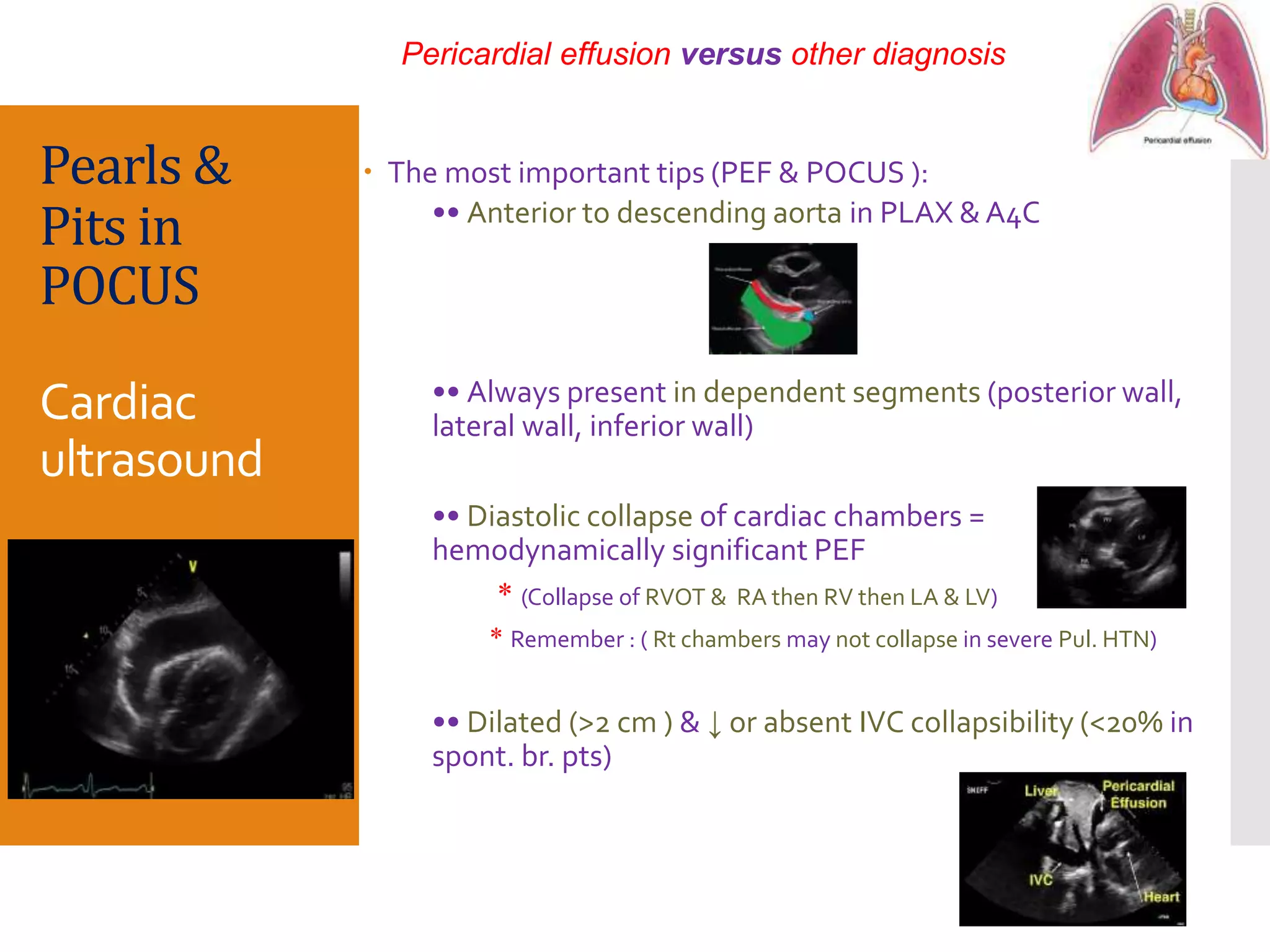 POCUS in critical care Jan 8th 2020 Teh Iran | PPTX