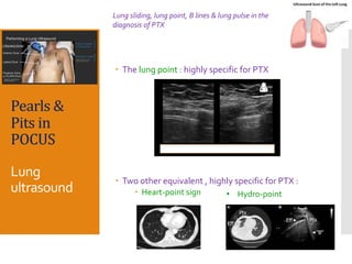 POCUS in critical care Jan 8th 2020 Teh Iran | PPTX