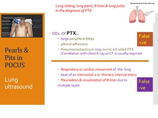 POCUS in critical care Jan 8th 2020 Teh Iran | PPTX