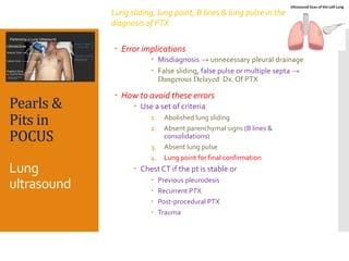 POCUS in critical care Jan 8th 2020 Teh Iran | PPTX