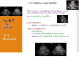 POCUS in critical care Jan 8th 2020 Teh Iran | PPTX