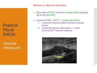 POCUS in critical care Jan 8th 2020 Teh Iran | PPTX