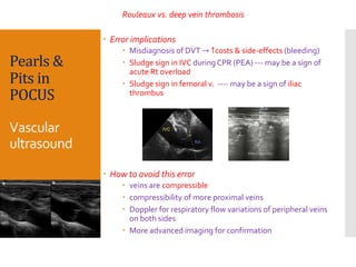 POCUS in critical care Jan 8th 2020 Teh Iran | PPTX