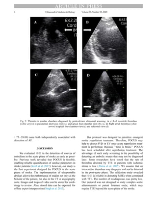 Pocus in acute ischemic stroke.docx | Heart and Cardiovascular Diseases ...