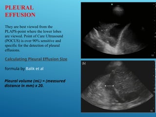 APPROACH TO POCUS IN ACUTE RESPIRATORY FAILURE.pptx