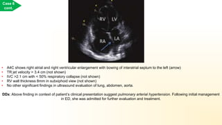 Pocus in syncope | PPTX