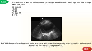 Pocus in syncope | PPT
