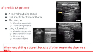 POCUS lung ultrasound (2).pptx ultrasound | PPTX