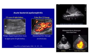 Point Of Care UltraSound in Urology ( POCUS ) | PPTX