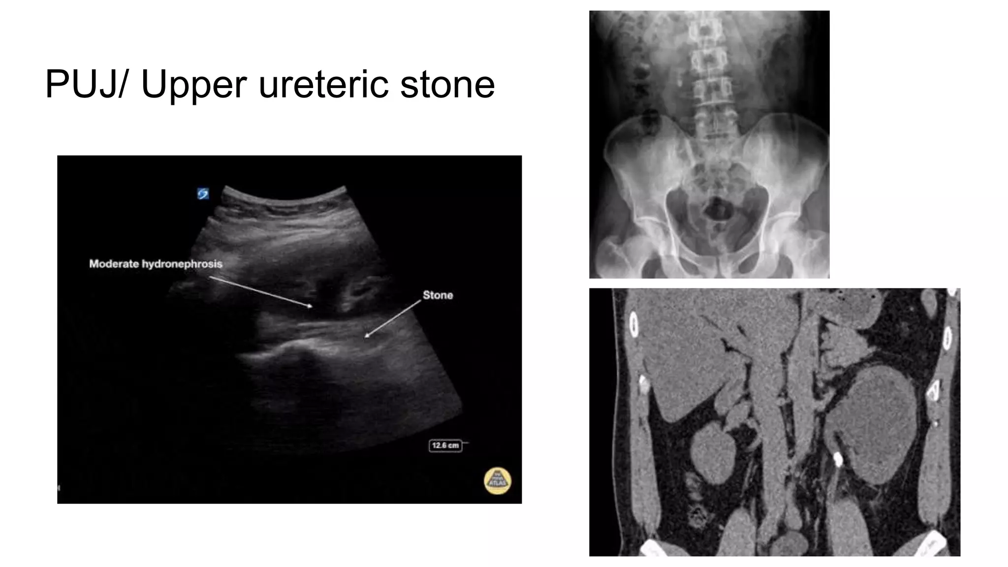 Point of Care Ultrasound ( urology ) | PPTX
