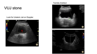 Point of Care Ultrasound ( urology ) | PPTX