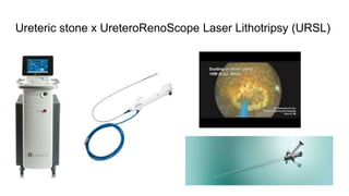 Point of Care Ultrasound ( urology ) | PPTX