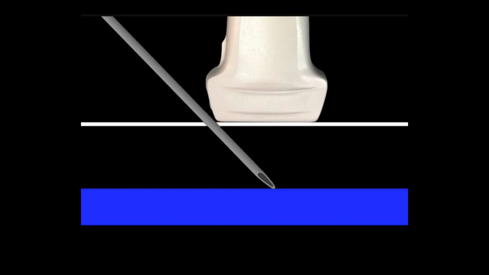 Vascular Access using POCUS Principles and Techniques | PPTX