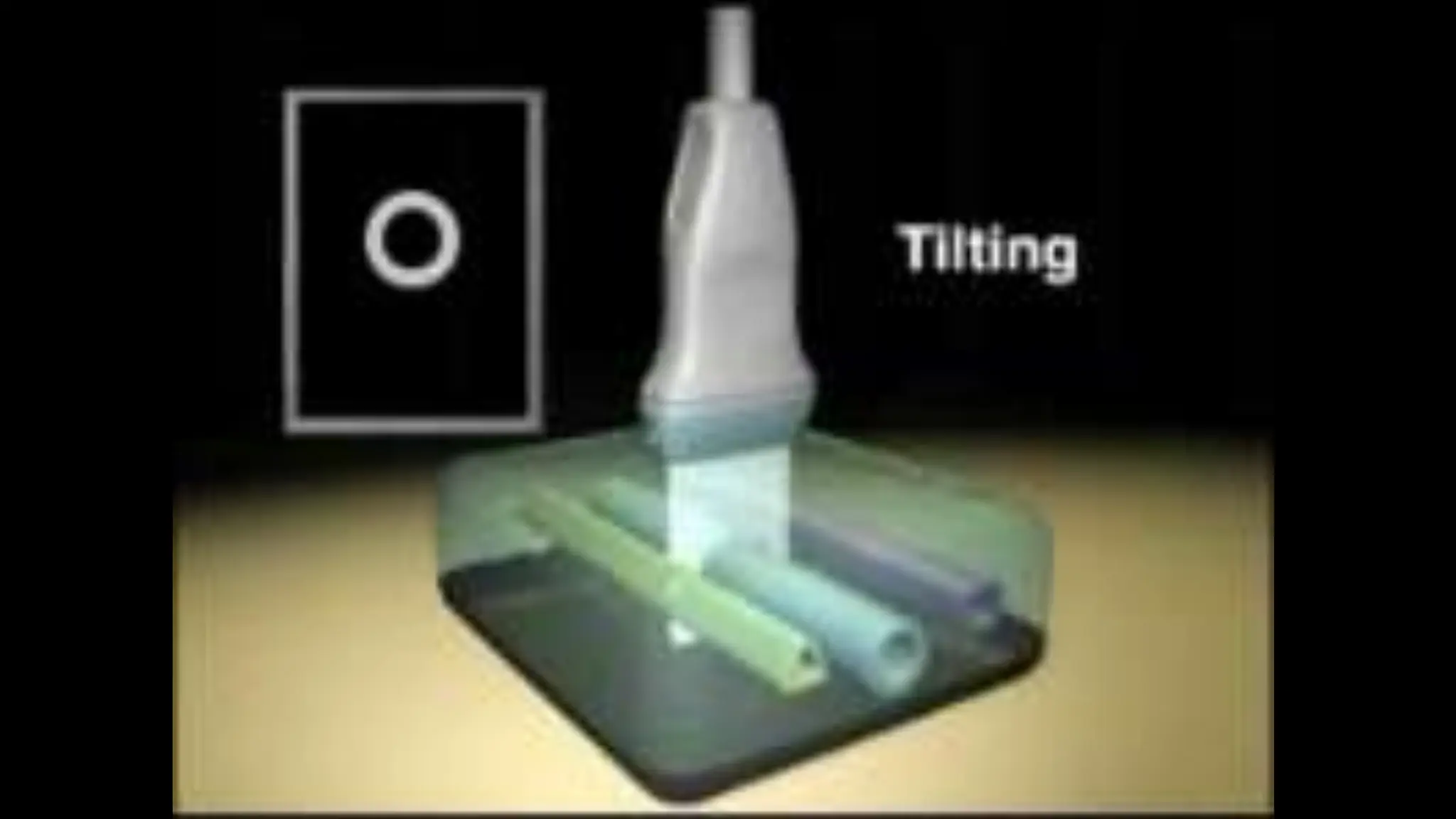 Vascular Access using POCUS Principles and Techniques | PPTX