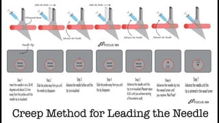 Vascular Access using POCUS Principles and Techniques | PPTX