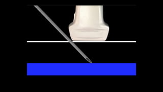 Vascular Access using POCUS Principles and Techniques | PPTX