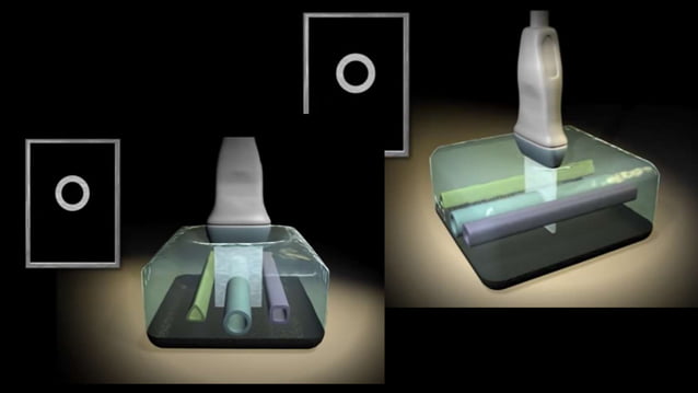 Vascular Access using POCUS Principles and Techniques | PPTX