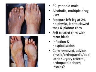 Homeless Podiatry Feet on the Street | PPTX | Foot Health | Diseases ...