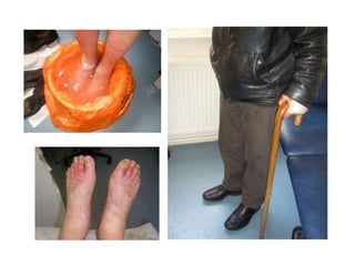 Homeless Podiatry Feet on the Street | PPTX