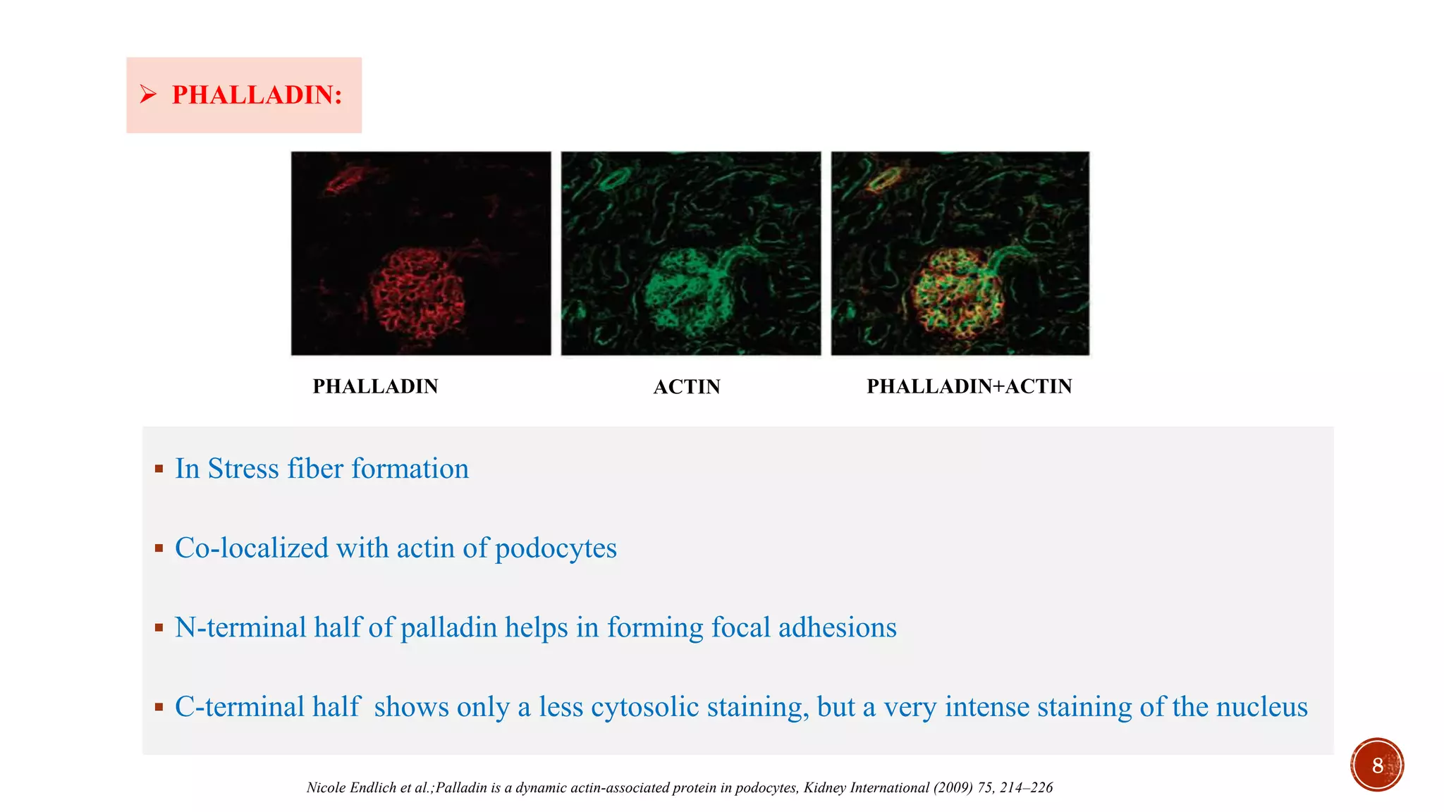 Podocyte mediated kidney diseases(diabetic nephropathy) | PPTX