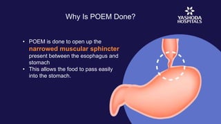 Peroral Endoscopic Myotomy (POEM) | Treatment For Achalasia of ...