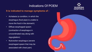 Peroral Endoscopic Myotomy (POEM) | Treatment For Achalasia of ...