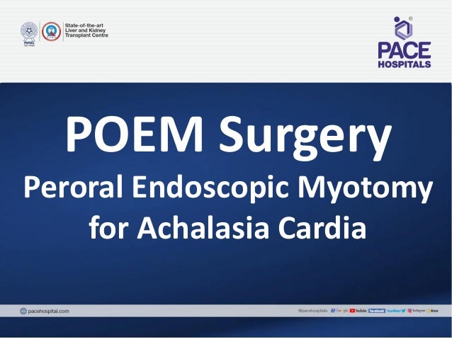POEM Procedure for Achalasia Cardia - PDF.pdf
