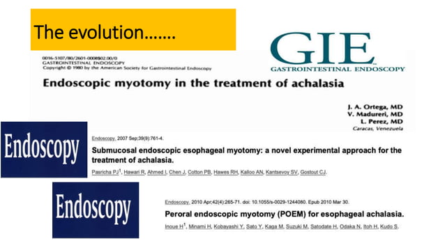 ACHALASIA CARDIA: ENDOSCOPIC THERAPY (POEM) | PPTX