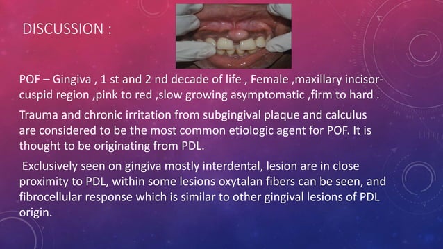 peripheral ossifying fibroma | PPTX | Dental Health | Diseases and ...