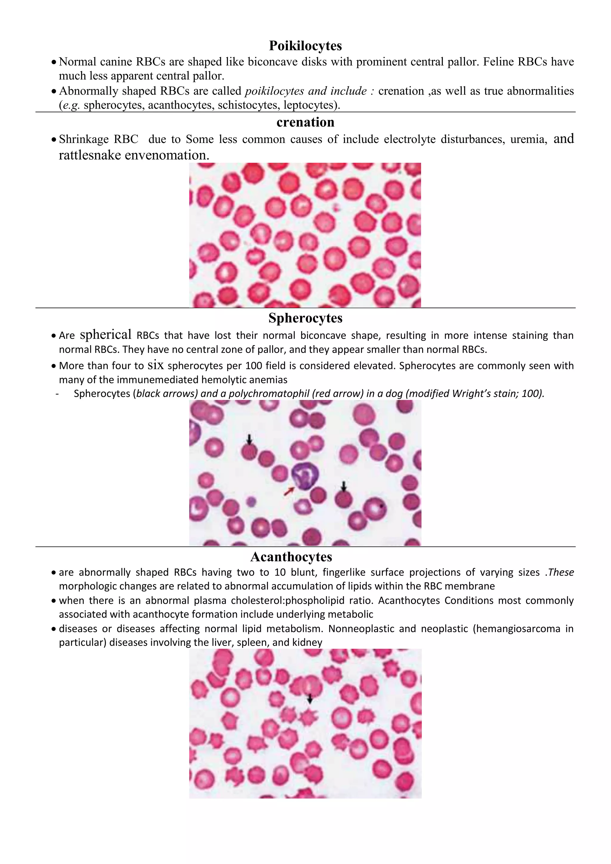 Poikilocytes2 عبد الامير عملي | DOCX