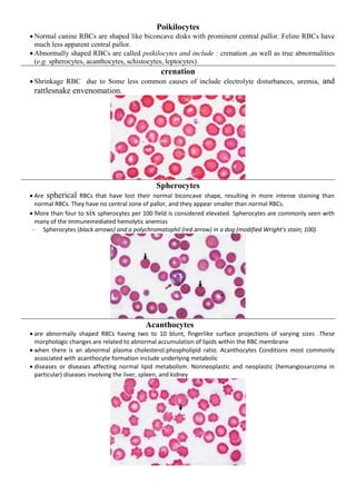 Poikilocytes2 عبد الامير عملي | DOCX