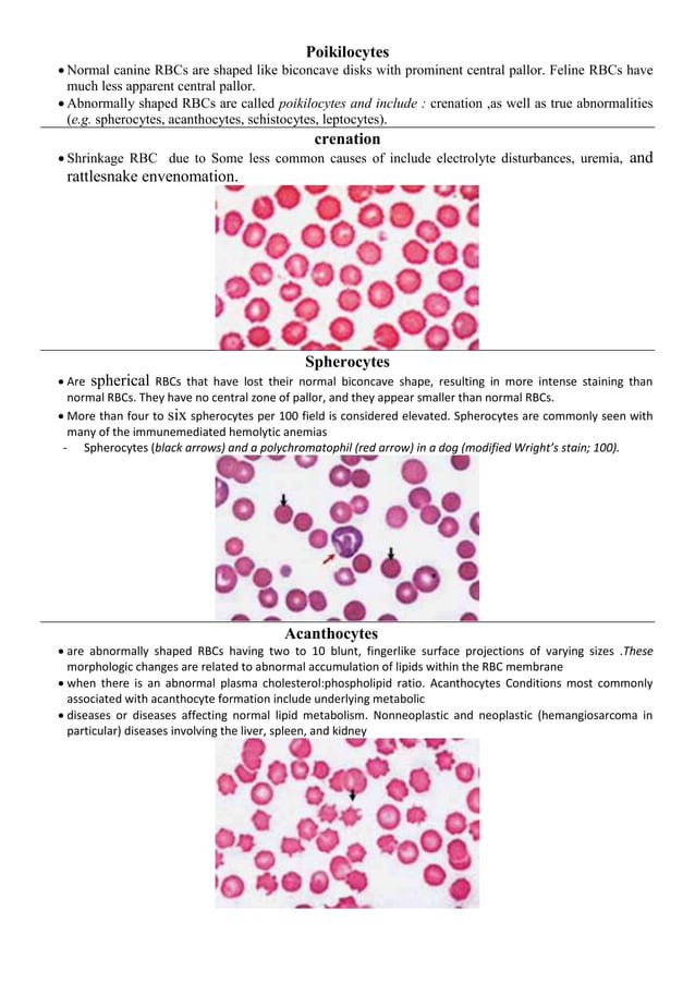 Poikilocytes2 عبد الامير عملي | PDF