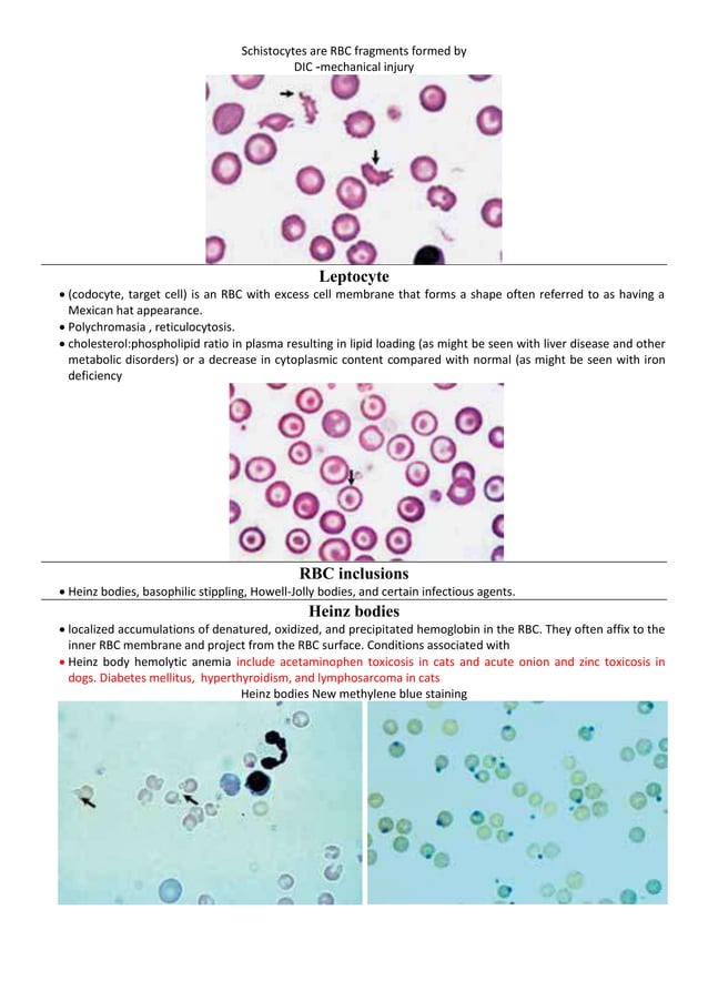 Poikilocytes2 عبد الامير عملي | PDF