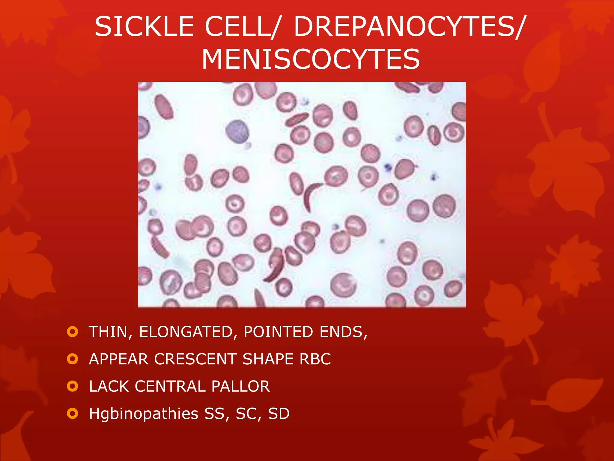 POIKILOCYTOSIS OF RBC | PPTX