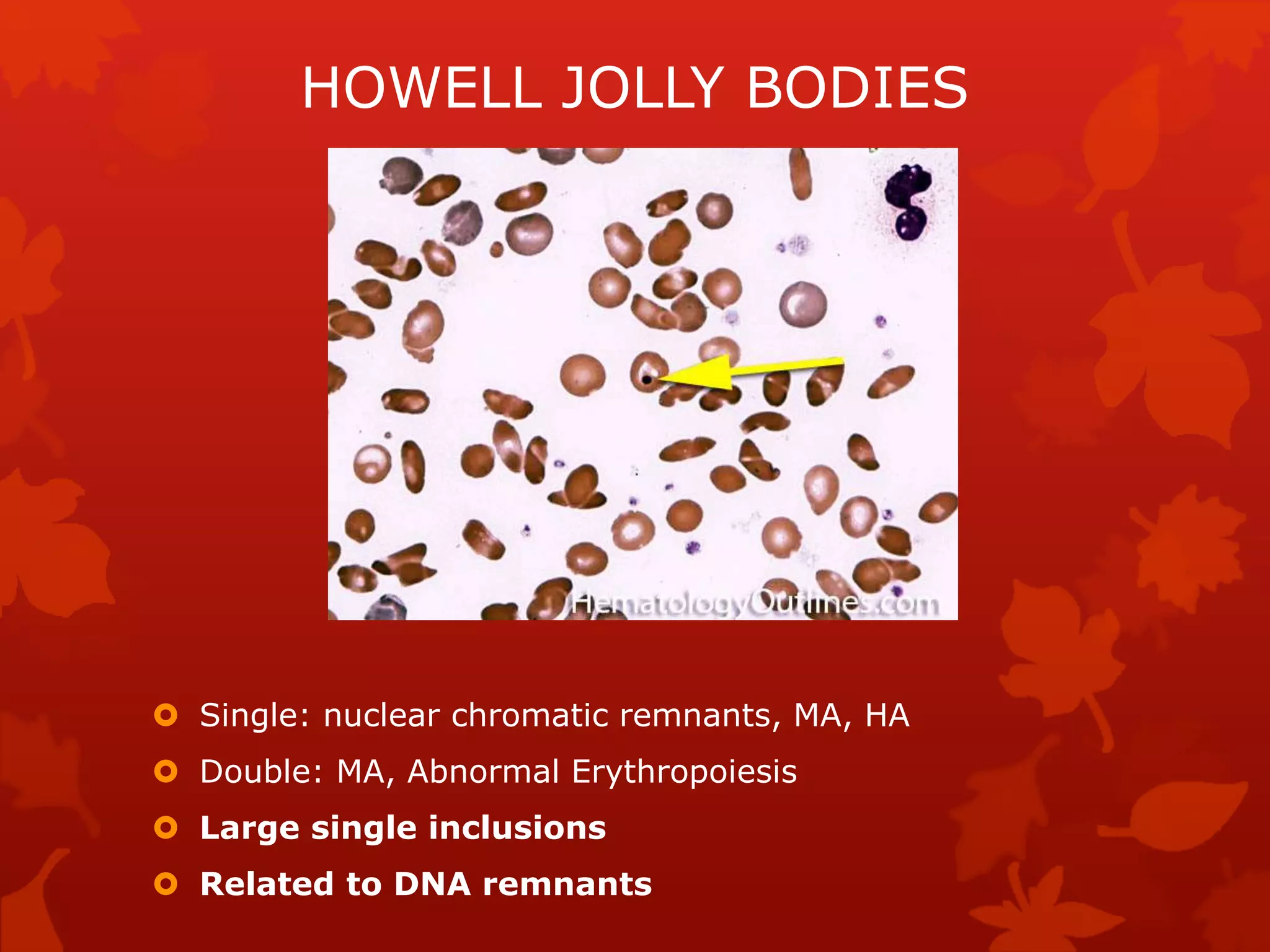POIKILOCYTOSIS OF RBC | PPTX