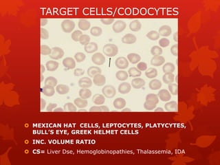 POIKILOCYTOSIS OF RBC | PPTX