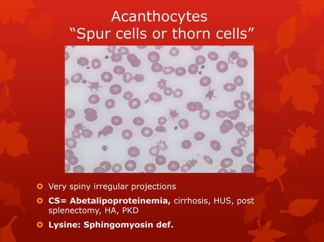 POIKILOCYTOSIS OF RBC | PPTX | Blood Disorders | Diseases and Conditions