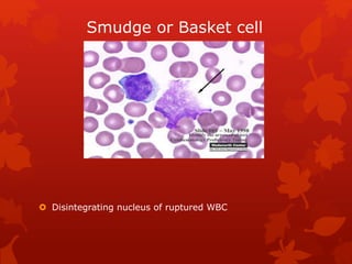 Basket Cell Smudge