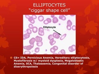 Elliptocyte