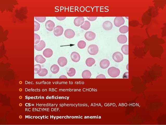 POIKILOCYTOSIS OF RBC