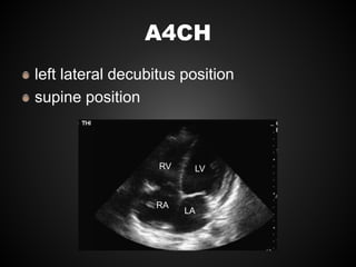 Focused Cardiac Ultrasound | PPTX