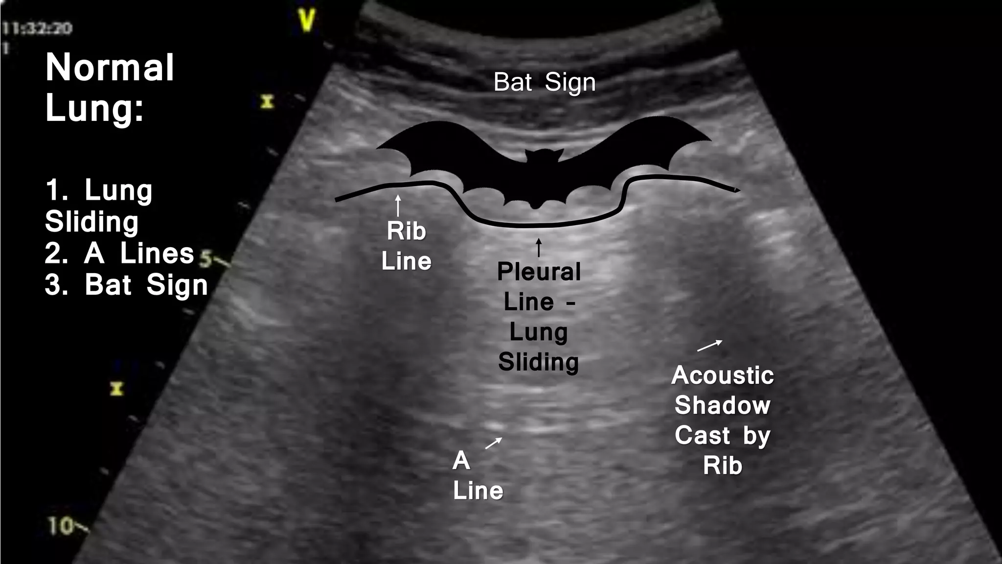 Point of Care Lung Ultrasound | PPTX