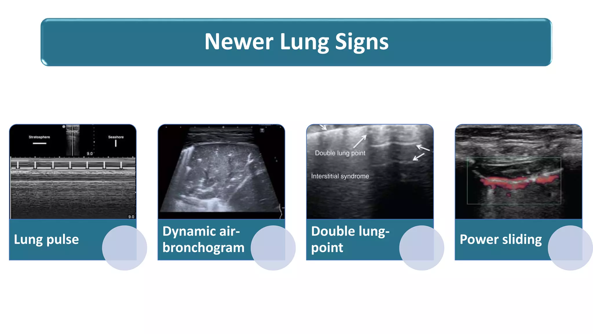 Point of Care Lung Ultrasound | PPTX