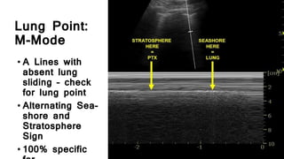 Point of Care Lung Ultrasound | PPTX