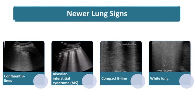 Point of Care Lung Ultrasound | PPTX | Lung and Respiratory Health ...