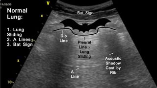 Point of Care Lung Ultrasound | PPT