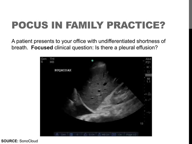Point of Care Ultrasound - Hyperechoic Future in Family Practice? | PPT