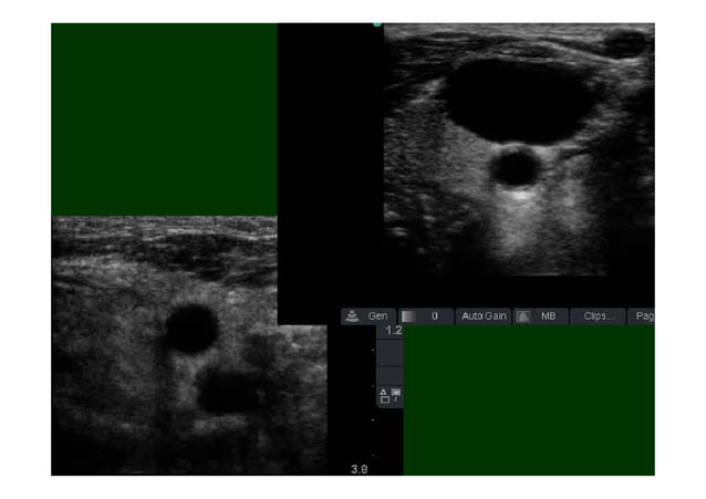Point of Care USG in ICU.pdf